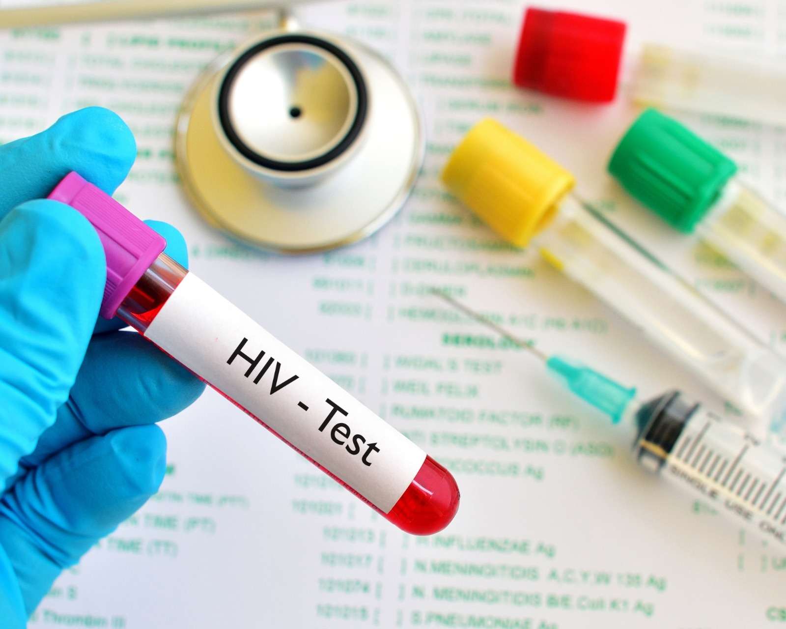 Different Types of HIV Testing - KLEM Clinics